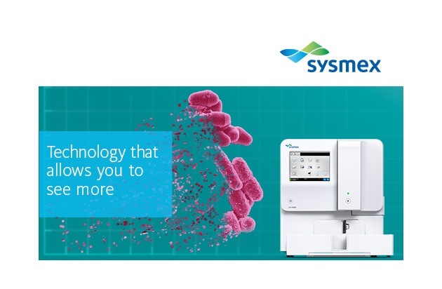 UF-1500 Fully Automated Urine Particle Analyzer – Dieda Corporation